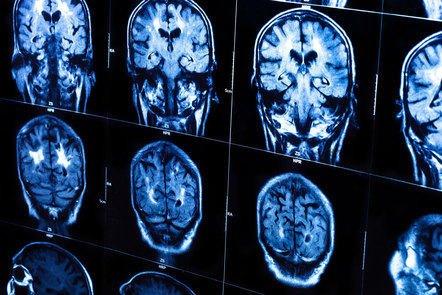 Good Brain, Bad Brain: basics (FutureLearn) | MOOC List